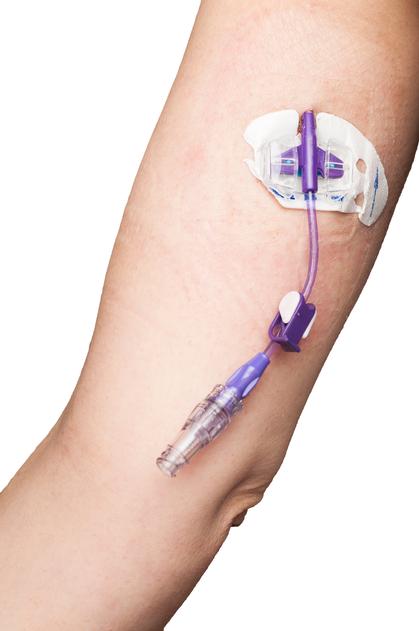 Care Of A Peripherally Inserted Central Catheter (PICC), 45% OFF